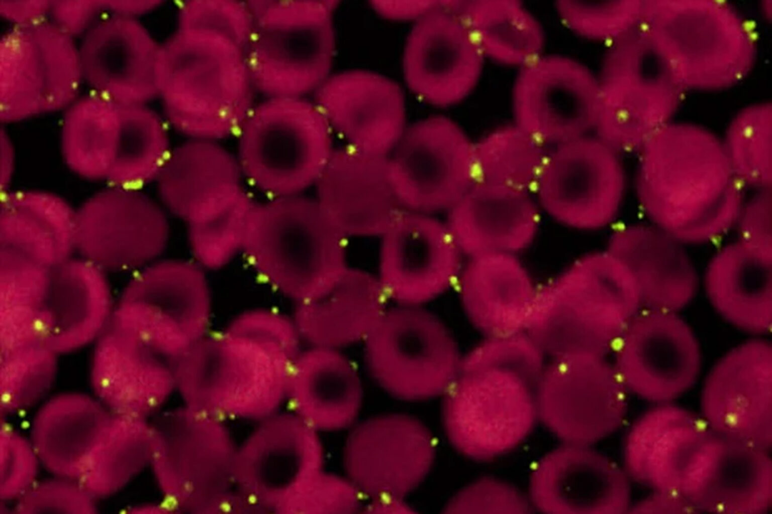 Advanced Inflammation Research & Lyme Disease Diagnostics | Tlab